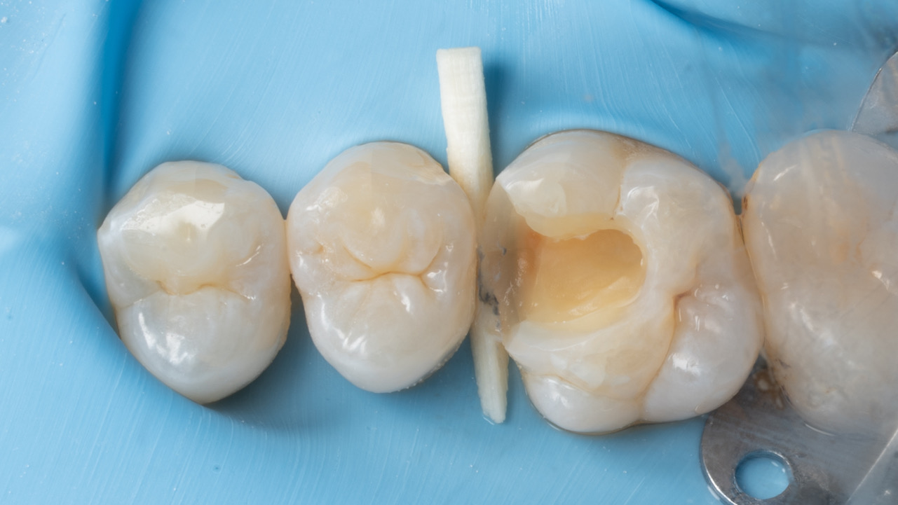 BACD Foundation Dentist Case Submission 2025 - BACD