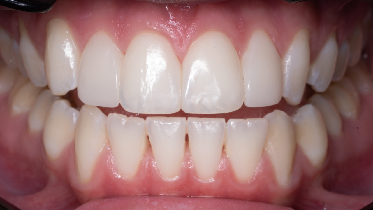 BACD Foundation Dentist Case Submission 2025 - BACD