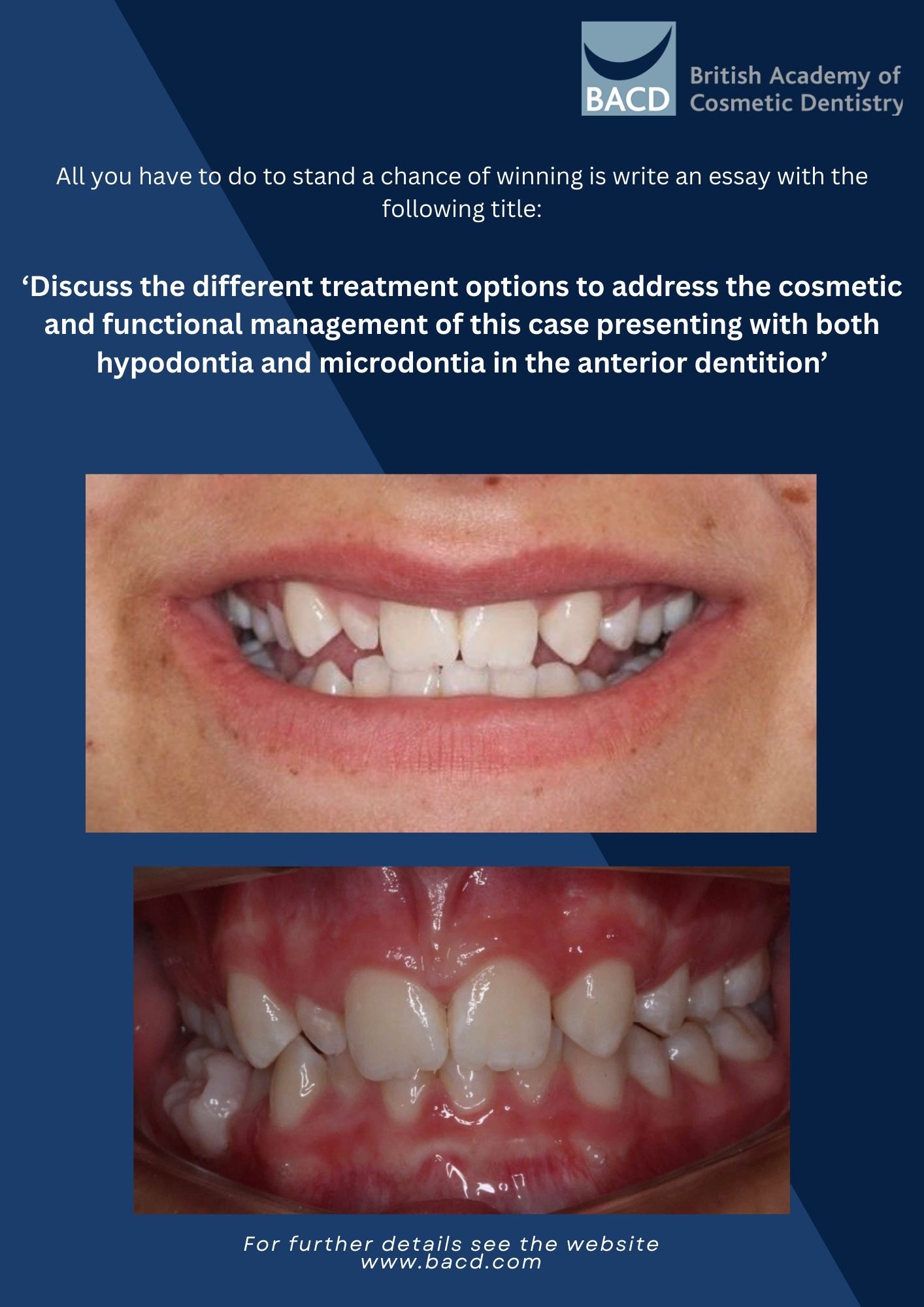 BACD Rising Star Essay Prize 2025 - BACD